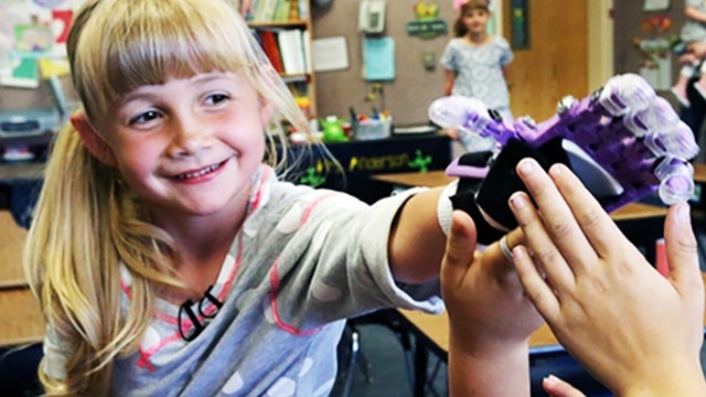 The Helping Hand Project: Changing Lives One Hand at a Time - Medical ...