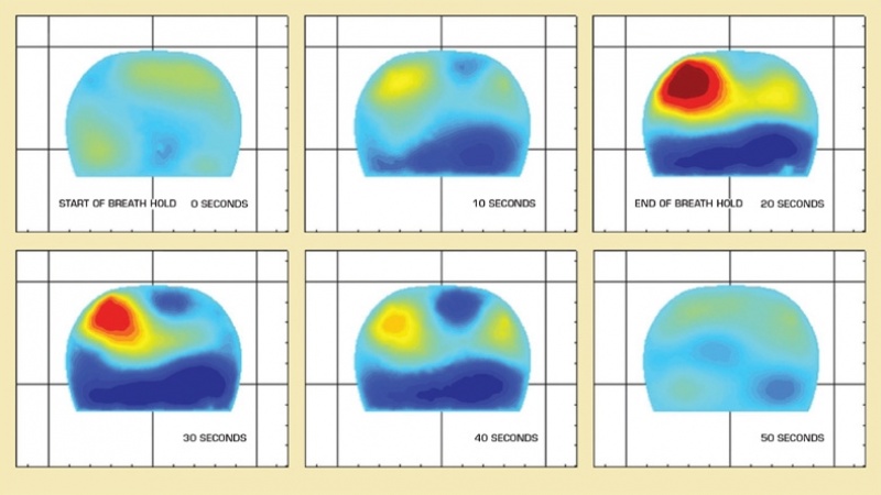 Near-Infrared Light May Identify Breast Cancer Patients Who Will ...