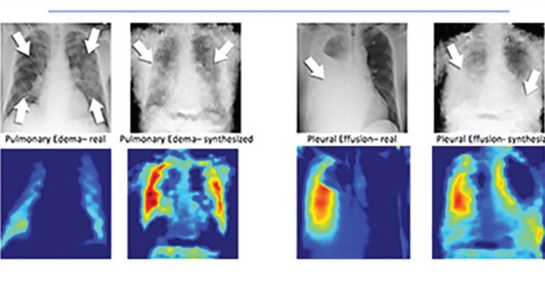 Training Artificial Intelligence with Artificial X-Rays - Medical ...